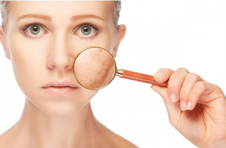 7 Skin Treatments More Effective On Hyperpigmentation – Omfom